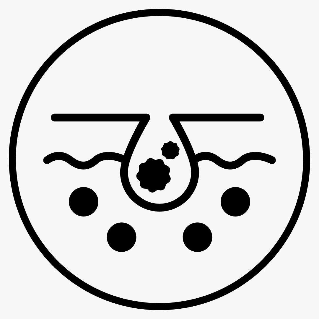 Seborrheic Dermatitis Treatment for Sensitive Skin | CLMD Skin Care ...